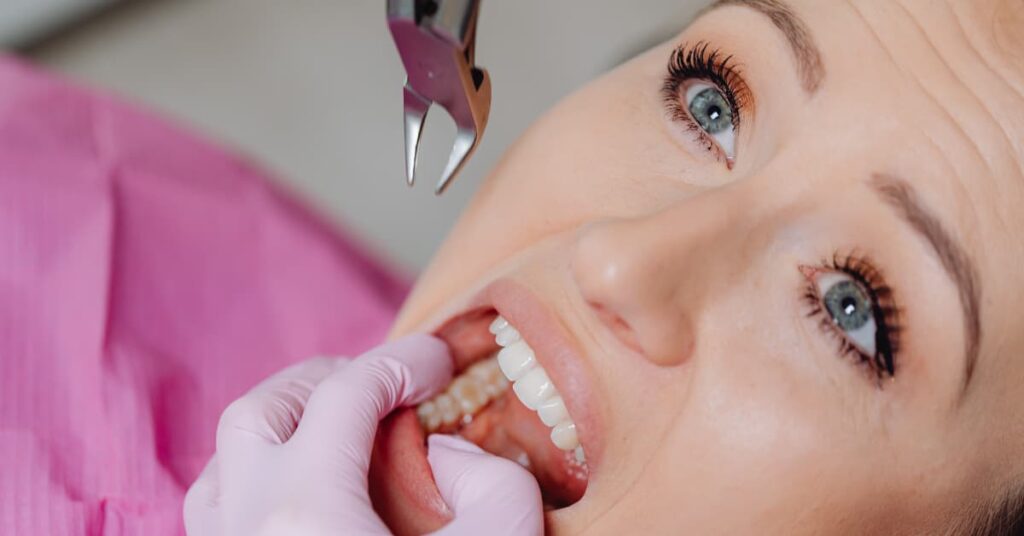 7 Alarming Dangers of Pulling an Abscessed Tooth