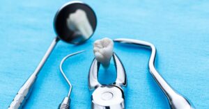 Affordable Wisdom Tooth Removal Cost in 2025: What to Expect and How to ...